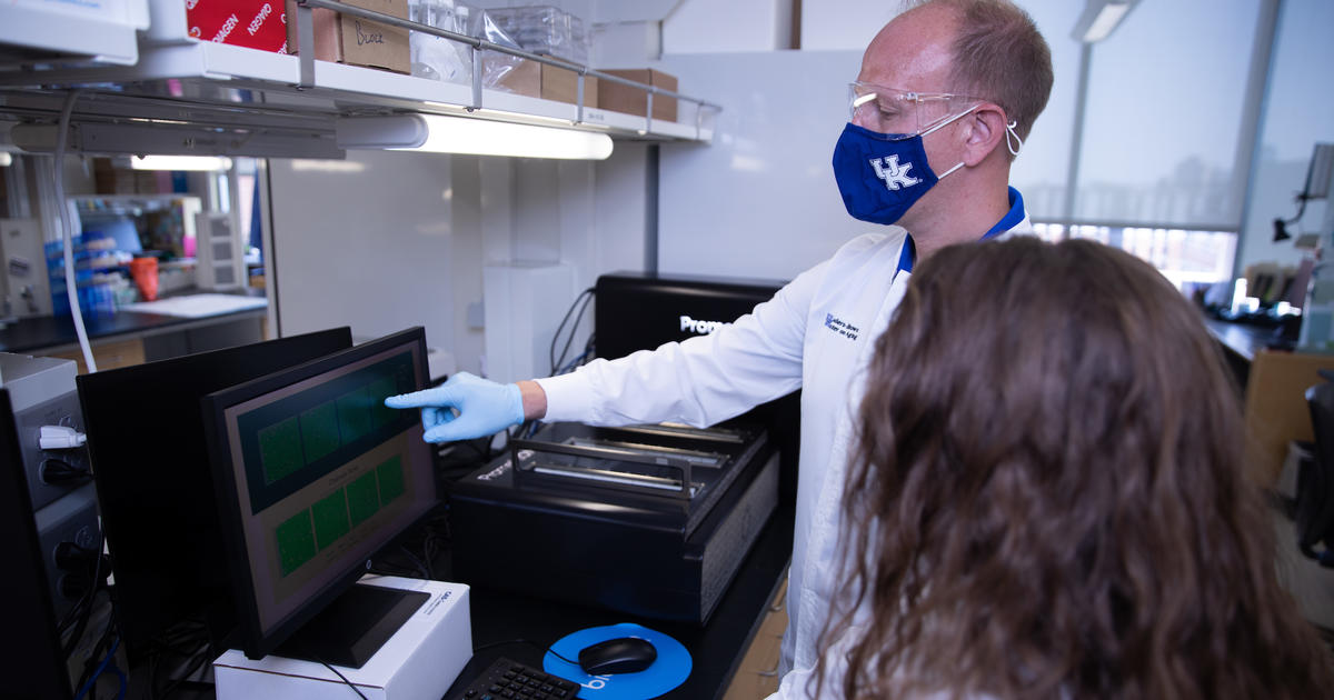 Recent Publication by Sanders-Brown Researchers Looks at Issue of Data ...