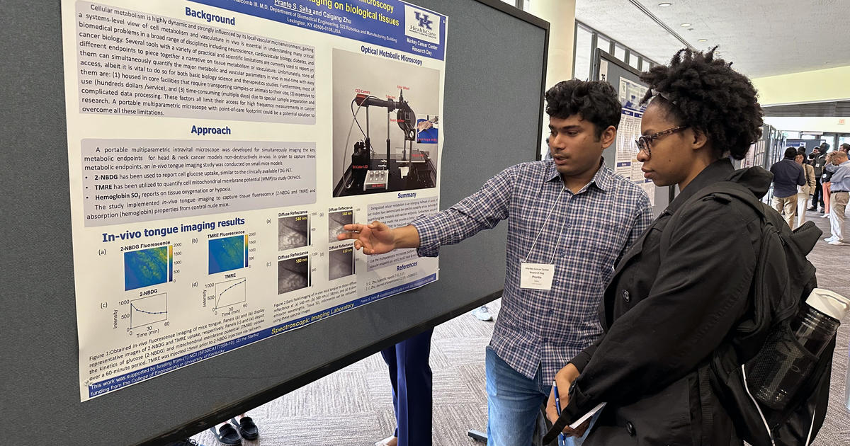 Innovation in cancer research showcased at Markey Research Day | UKNow