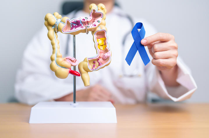 What to know about colorectal cancer rates increasing in younger adults ...