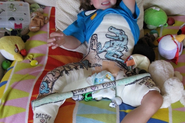Grant Provides Special Car Seats for Kids With Femur, Pelvic Injuries ...